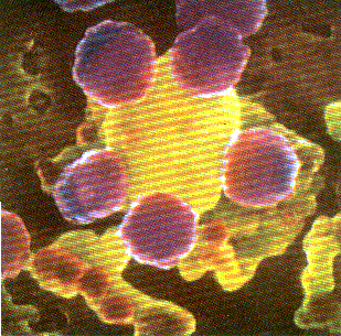 +-Sida+-: (*)O Que provoca a Sida(*)